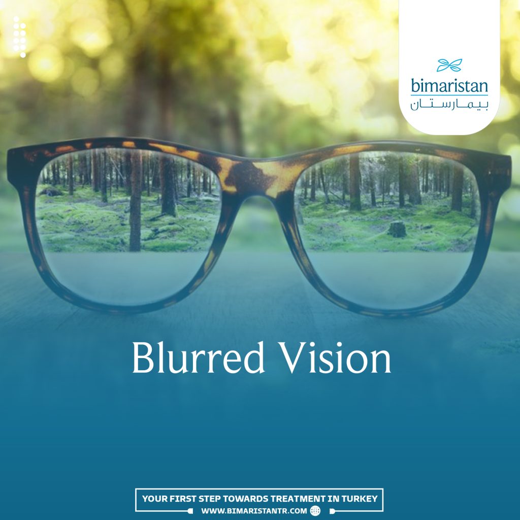 Top 10 Causes of Blurry Vision (Foggy eyes) - Bimaristan