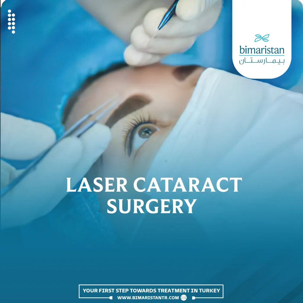 Laser-Assisted Cataract Surgery in Turkey - بيمارستان