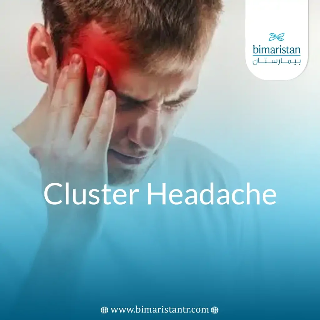 Cluster Headache Causes and Treatment in Turkey - Bimaristan