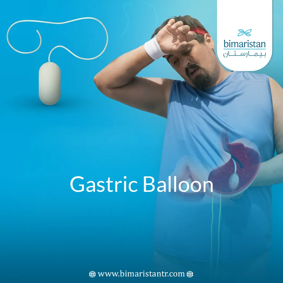 Gastric Balloon in Turkey - Bimaristan