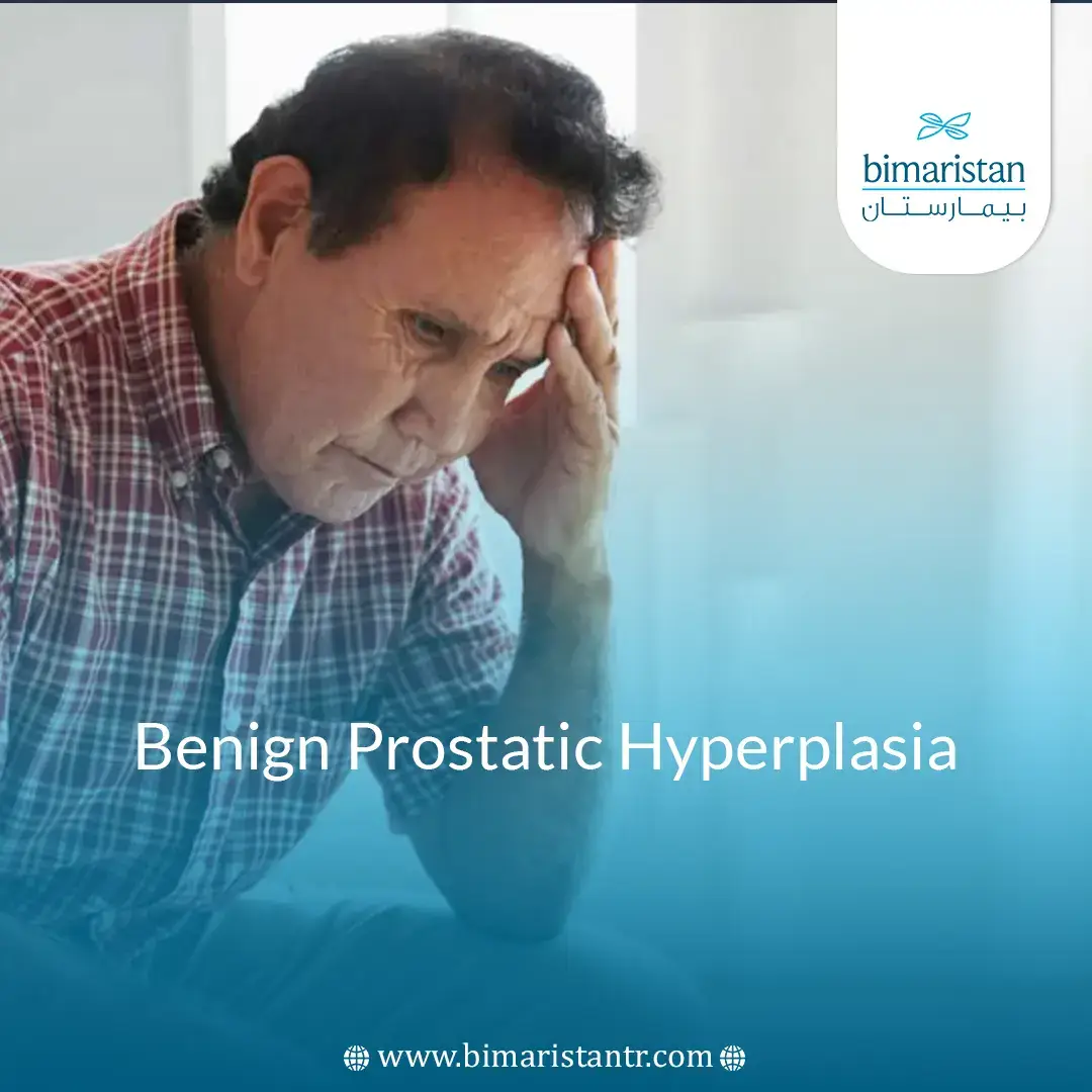 Benign Prostatic Hyperplasia Symptoms - Bimaristan
