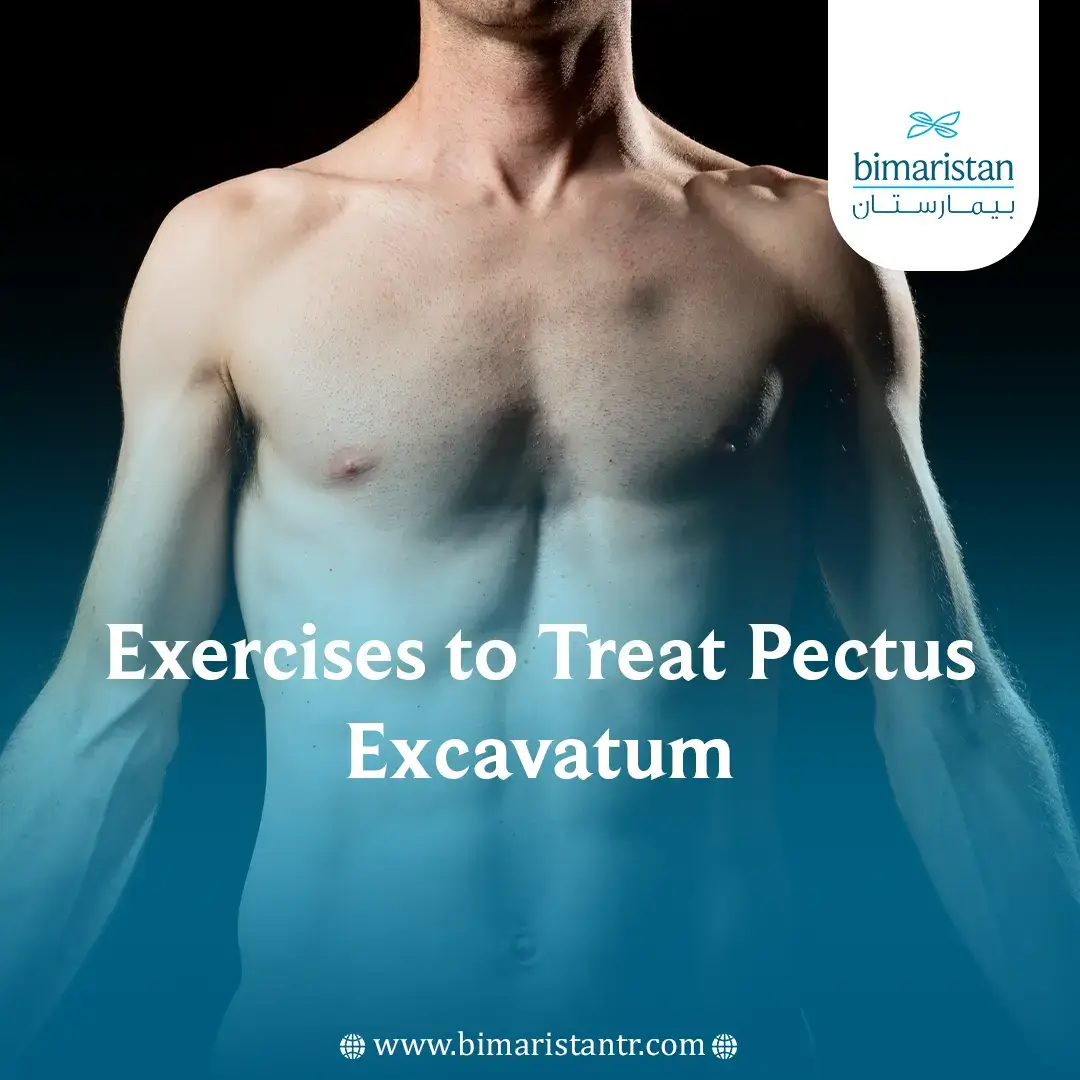 Exercises To Treat Pectus Excavatum in Turkey 2025