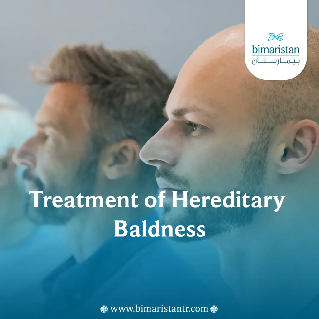 Treatment of Hereditary Baldness - بيمارستان