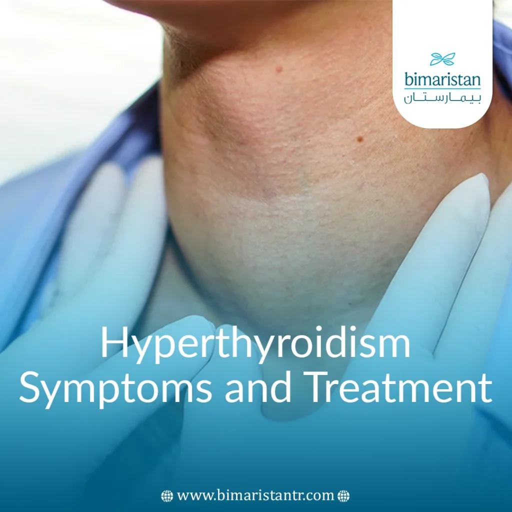 Hyperthyroidism Symptoms Treatment - Bimaristan