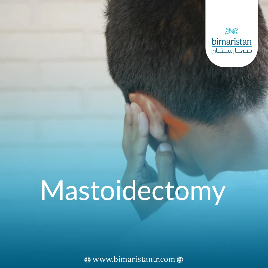 Mastoidectomy - Petromastoid Inflammation and Its Symptoms