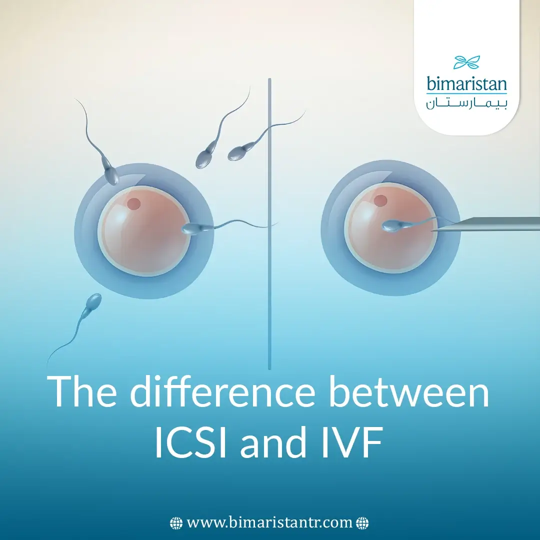 The difference between IVF and ICSI: A comprehensive guide for parents