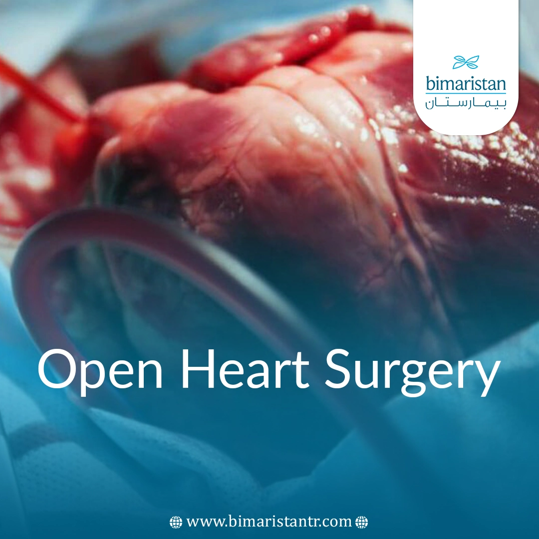 Open Heart Surgery in Turkey - Bimaristan