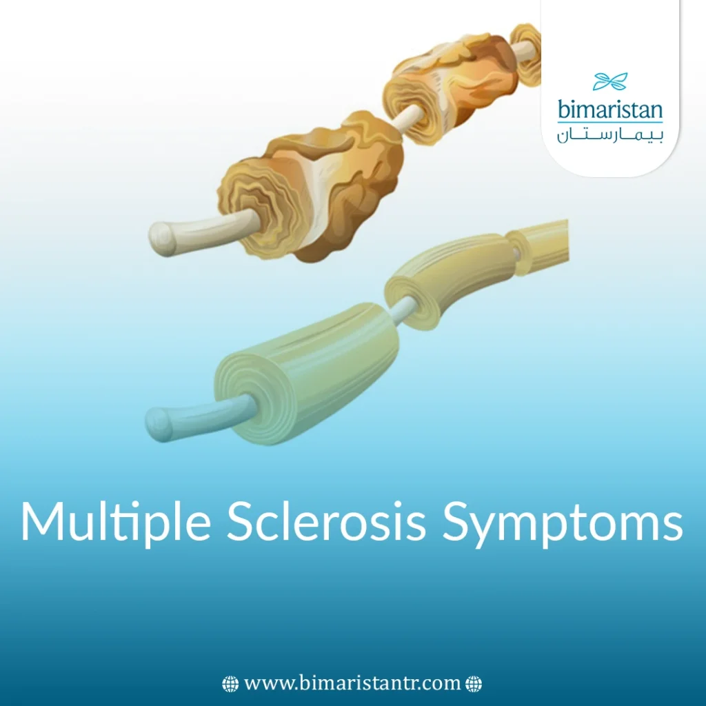 Multiple Sclerosis Symptoms and Causes - Bimaristan