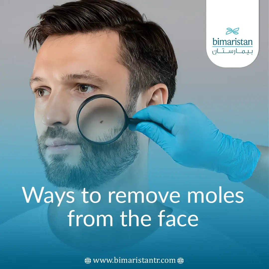 Ways to Remove Moles from the Face