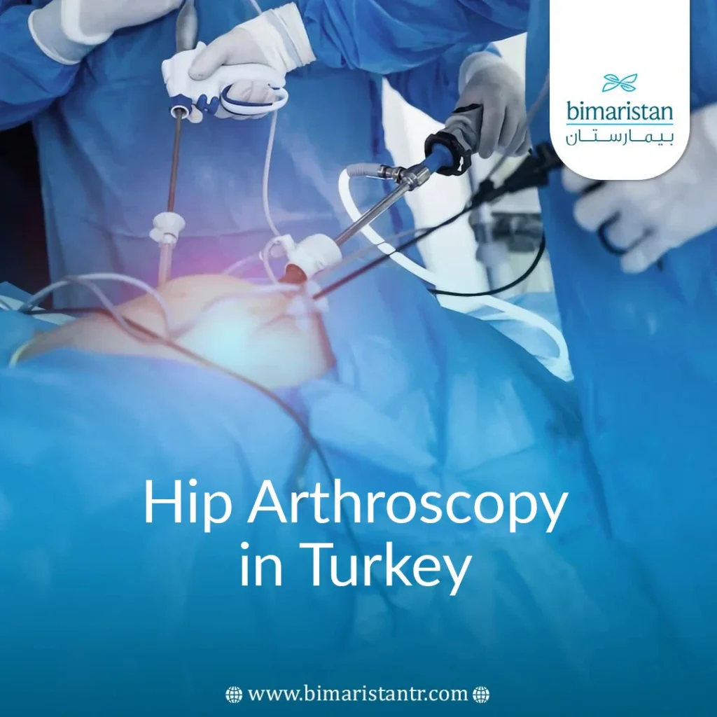 Hip Arthroscopy Procedure in Turkey 2025 - بيمارستان