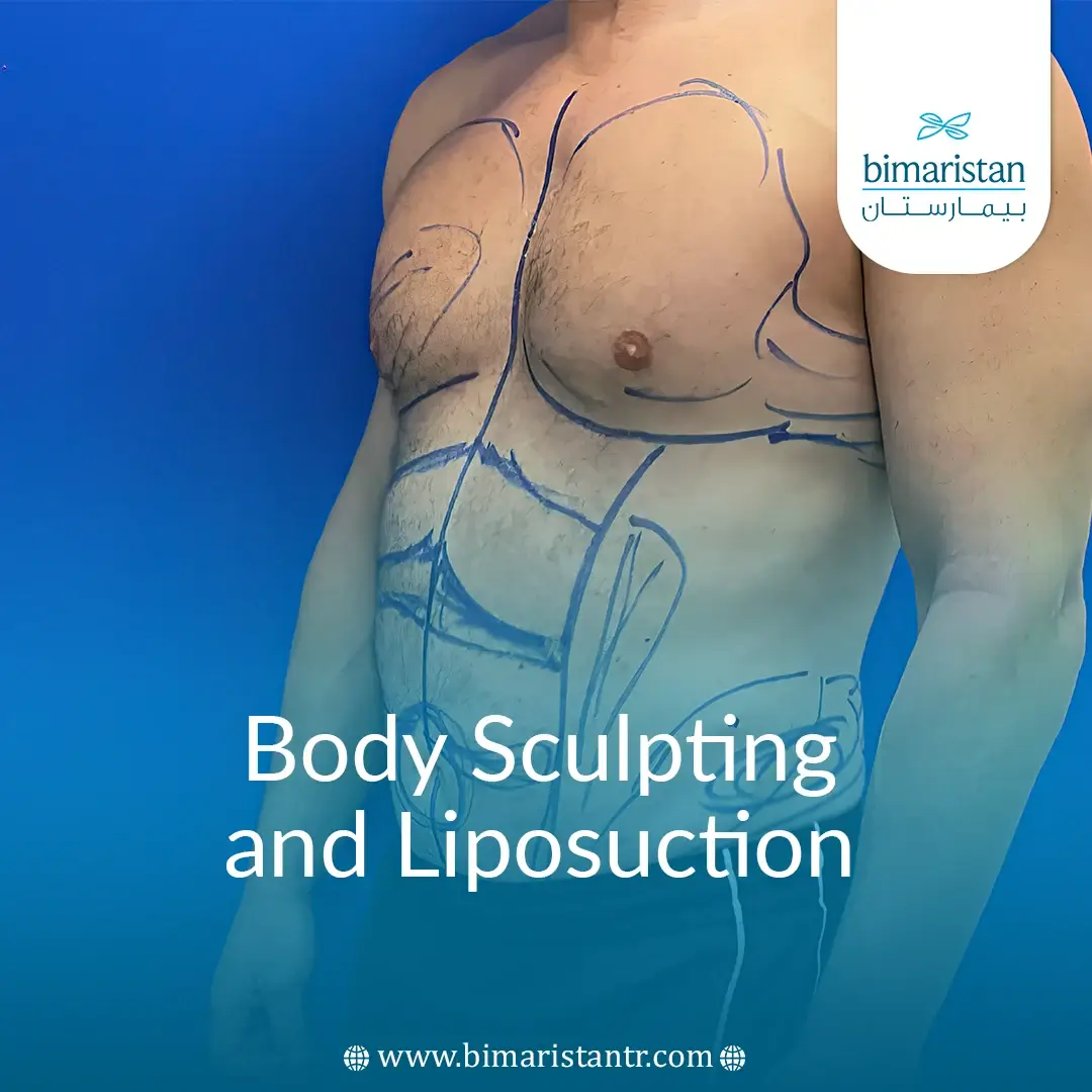 بيمارستان - Body Sculpting and Liposuction in Turkey