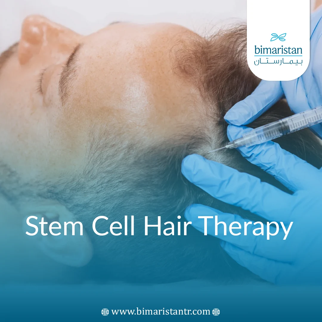 Benefits of Stem Cells Hair Therapy in Turkey