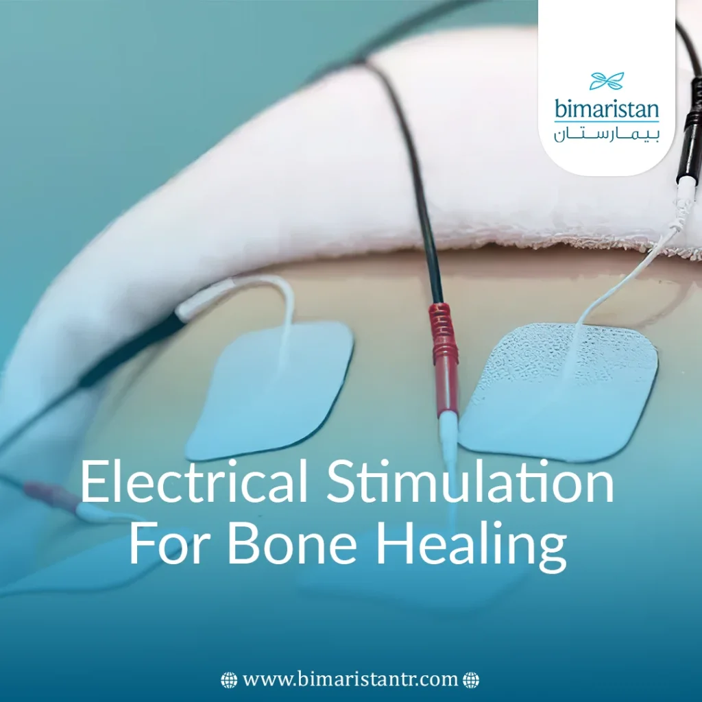 Electrical Stimulation for Bone Healing in Turkey