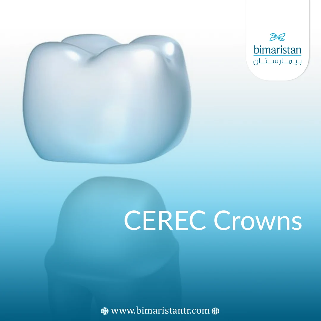 CEREC Crowns in Turkey 2024 - Bimaristan