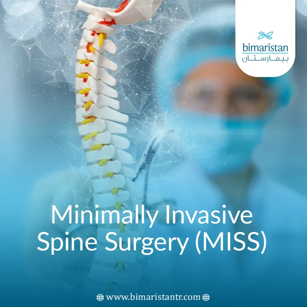 Minimally Invasive Spine Surgery (MISS) in Turkey