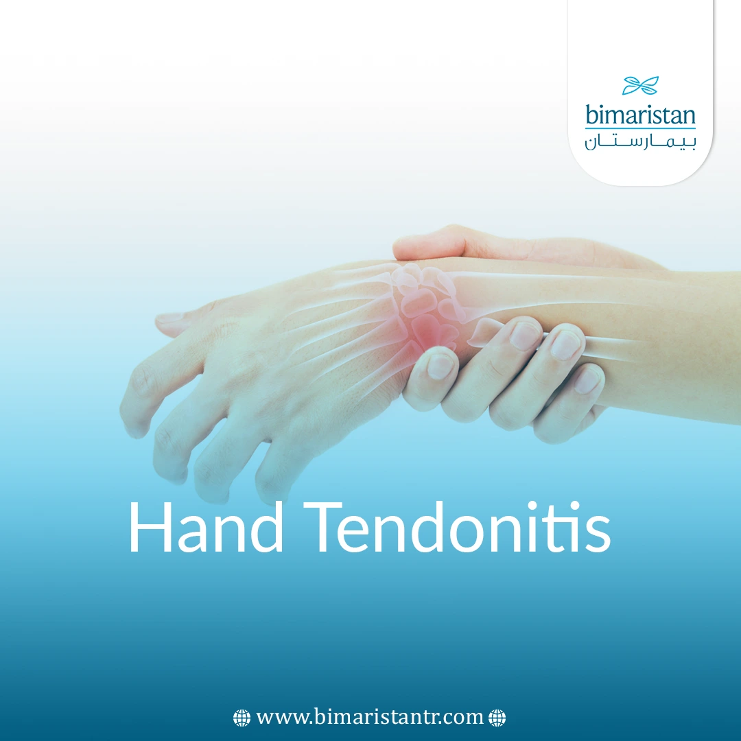 Hand Tendonitis Symptoms and Treatment Options in Turkey