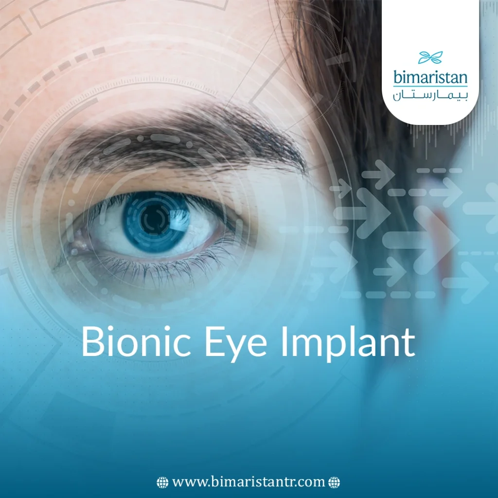 Bionic Eye Implant in Turkey - Bimaristan