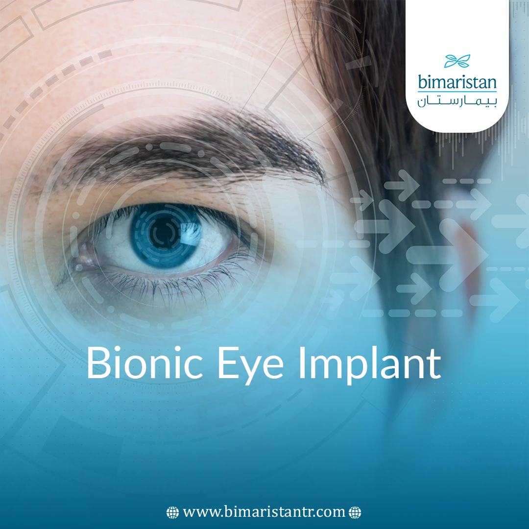 Bionic Eye Implant in Turkey - Bimaristan