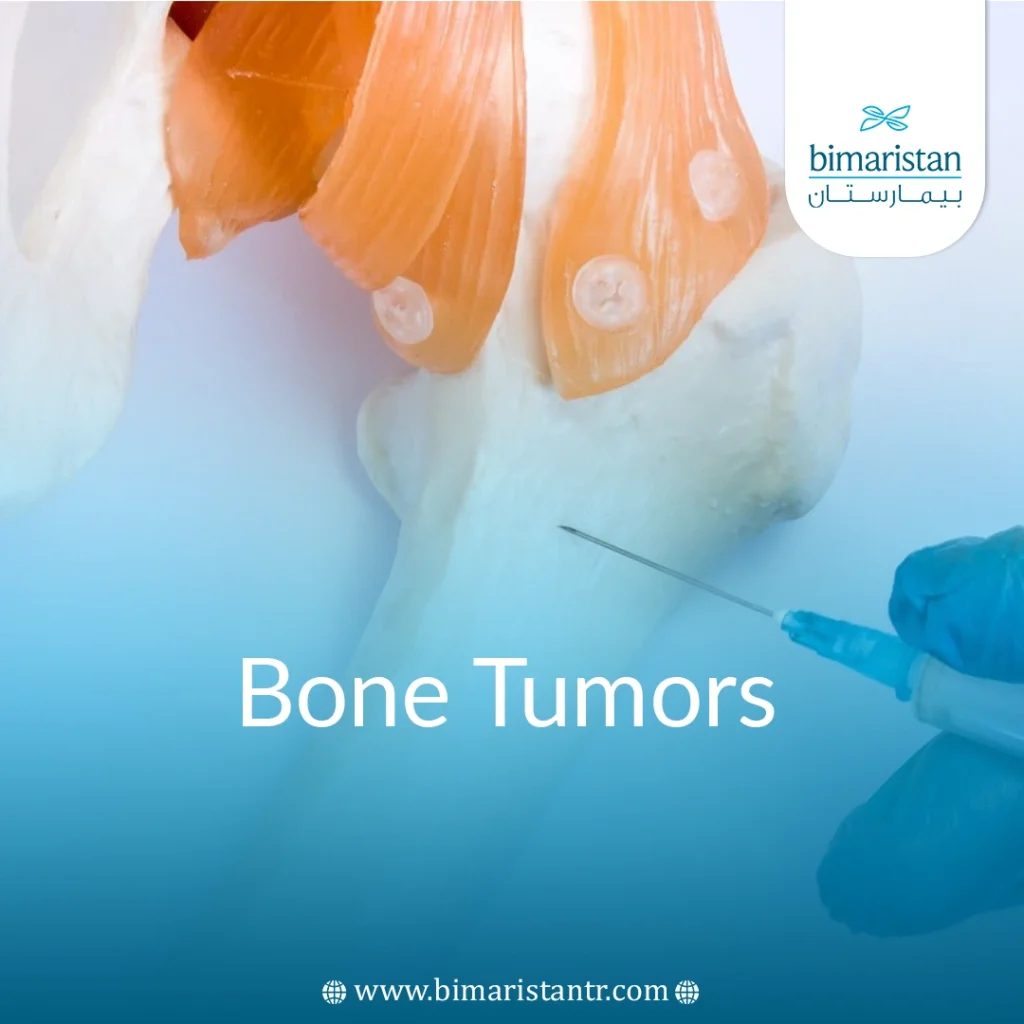 Bone Tumors Treatment in Turkey - Bimaristan
