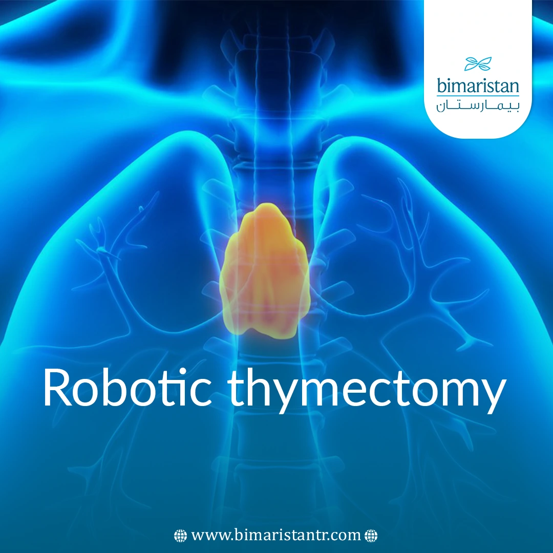 Robotic Thymectomy: Advanced Minimally Invasive Treatment