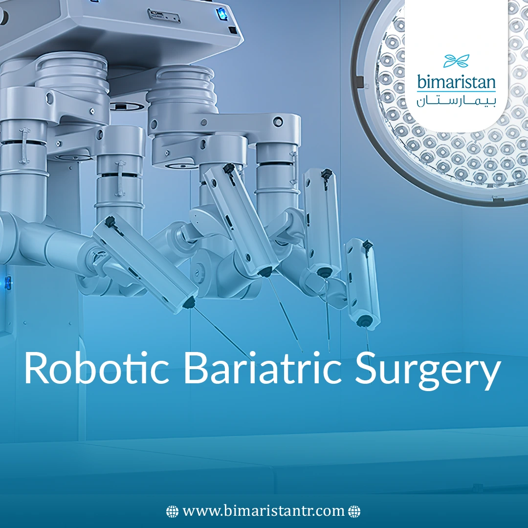 Robotic Bariatric Surgery in Turkey/Istanbul - Bimaristan