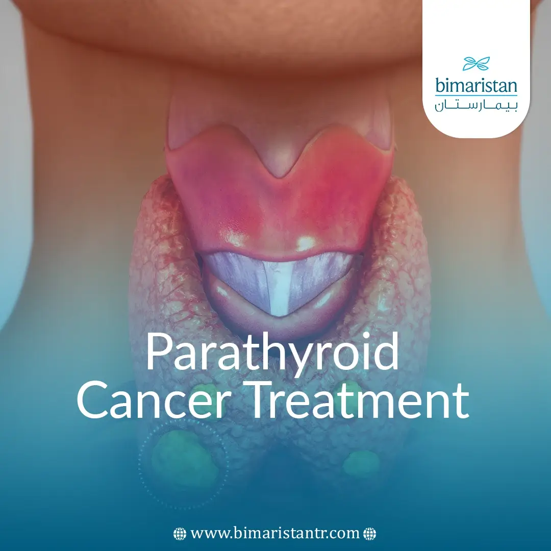 Parathyroid cancer treatment in Turkey - بيمارستان