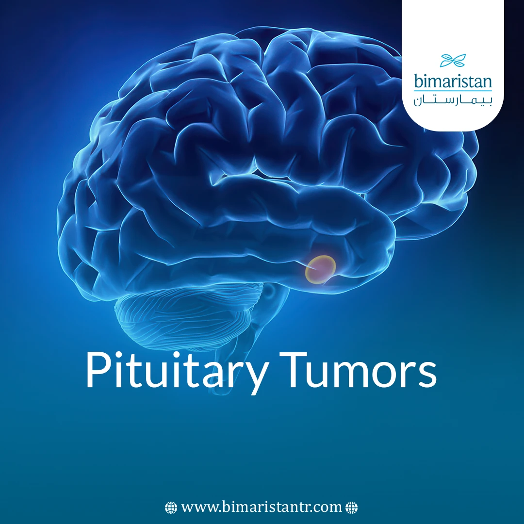 Pituitary Tumors: Causes, Symptoms & Treatment Options