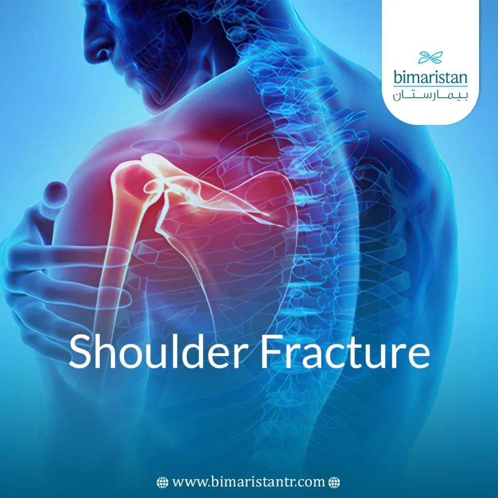 Shoulder Fracture: Symptoms, Types, and Treatment Options
