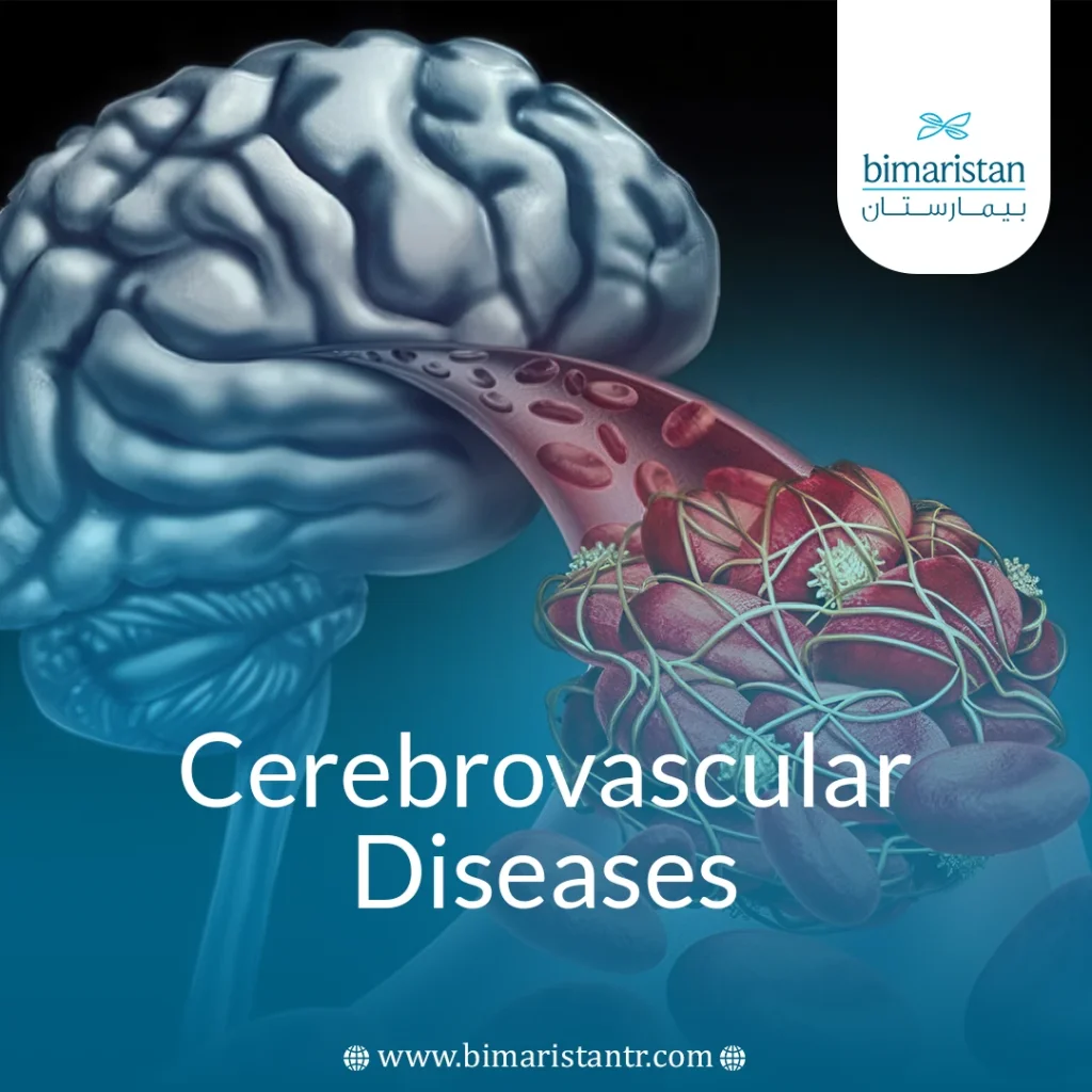 Cerebrovascular Diseases: Major Causes & New Treatments