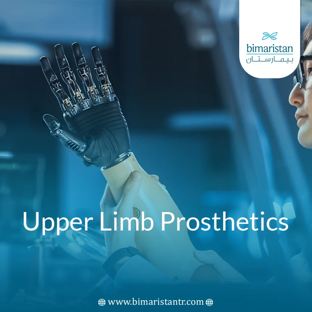 Upper Limb Prosthetics: Restore Mobility & Quality of Life