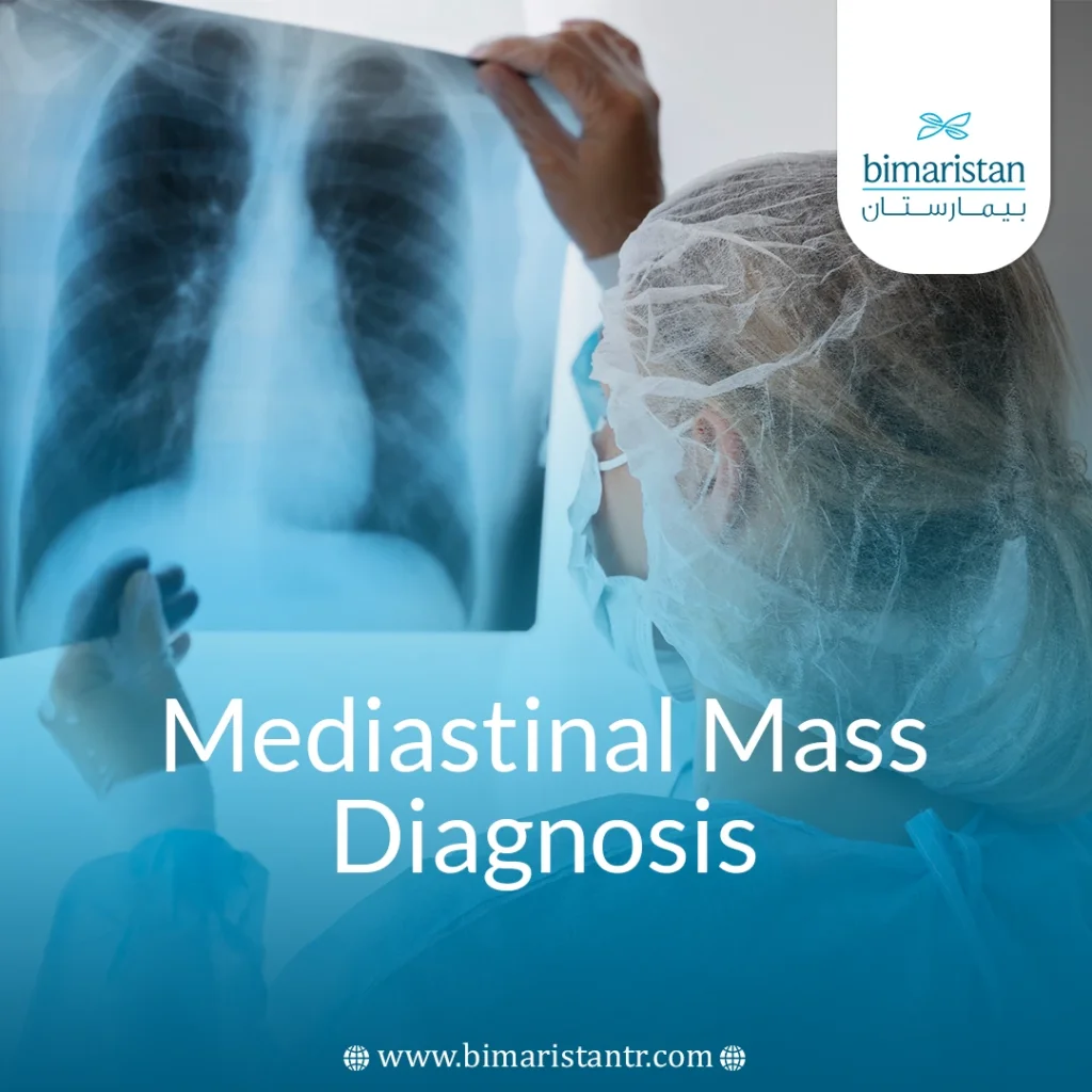 Mediastinal Mass Diagnosis: Top Methods to Identify Causes