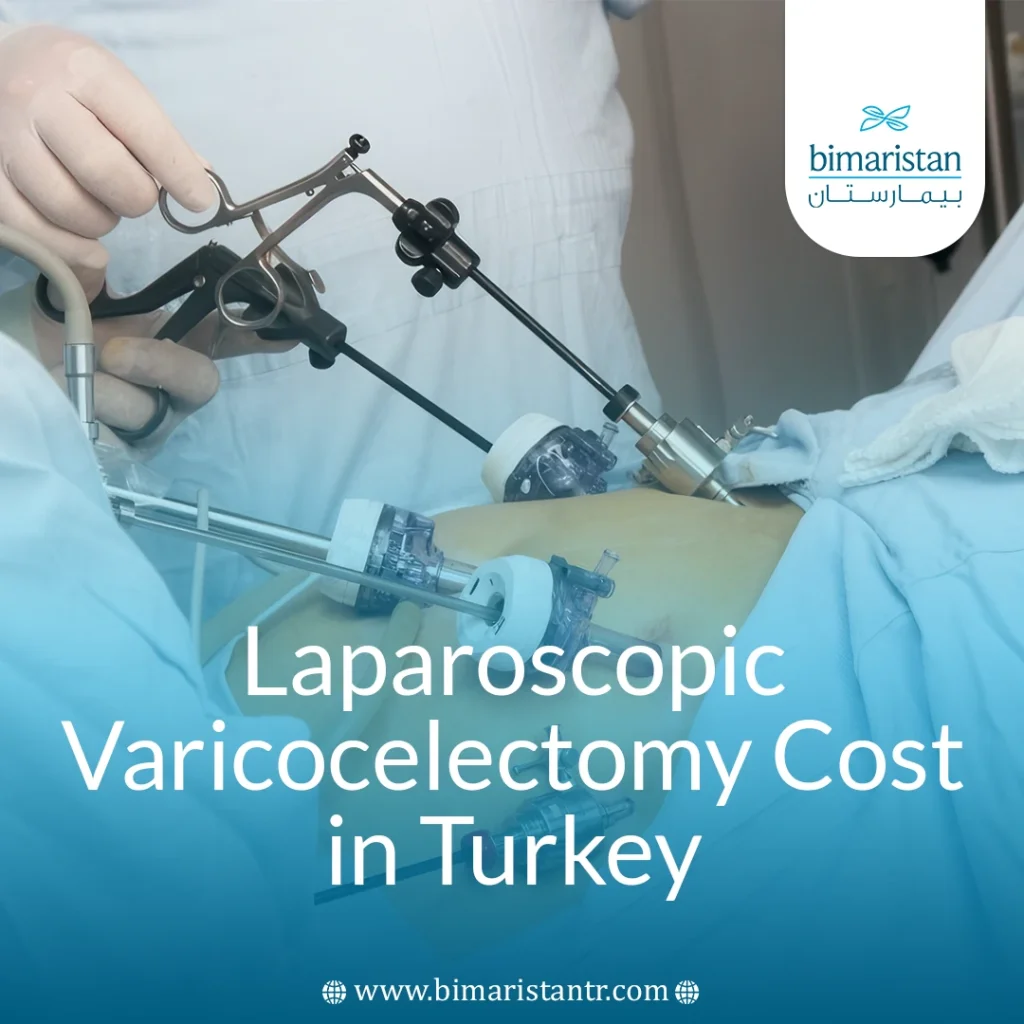 Laparoscopic Varicocelectomy Cost in Turkey: 2025 Guide
