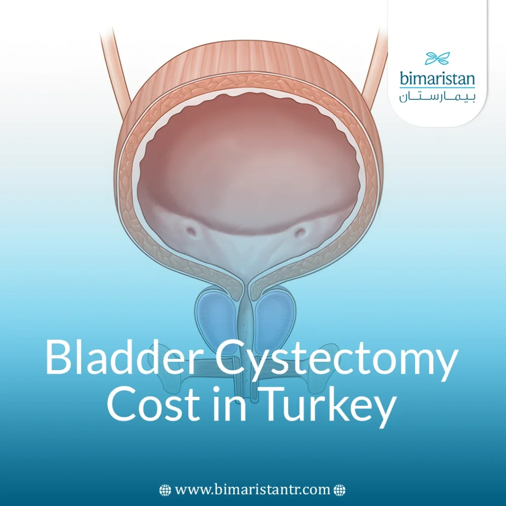 Bladder Cystectomy Cost in Turkey 2025 - Bimaristan