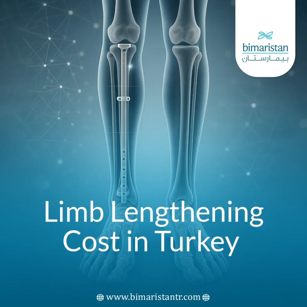 Limb Lengthening Cost in Turkey 2025 - Bimaristan