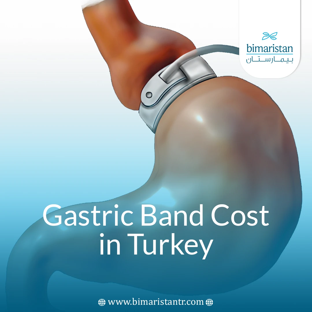 Gastric Banding Cost in Turkey: Complete 2025 cost Breakdown