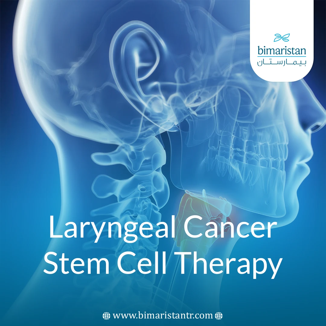 Laryngeal Cancer Stem Cells Therapy - Bimaristan