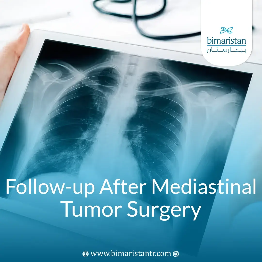 Follow-Up After Mediastinal Tumor Surgery: Full Guide