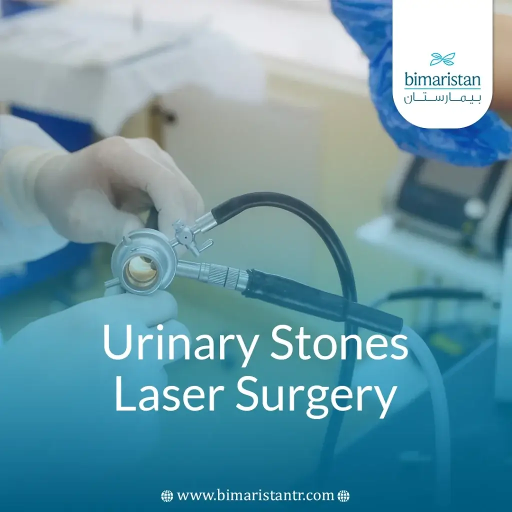 Urinary Stones Laser Surgery: Benefits & Risks vs. Options
