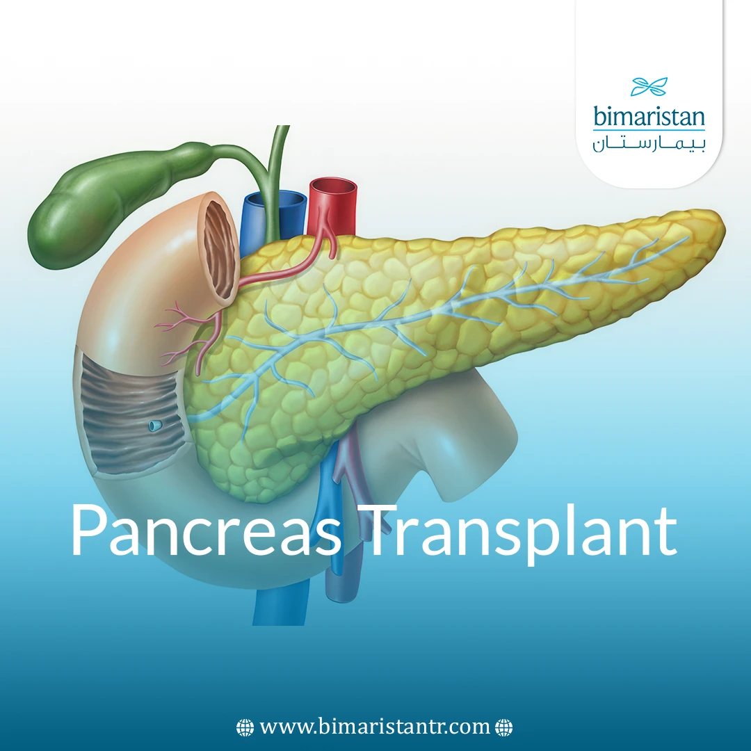 Pancreas Transplant in Turkey - Bimaristan